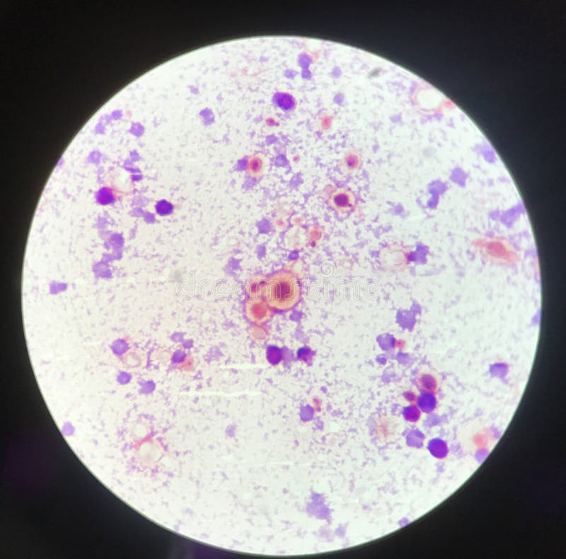 Macro-ontginnende Gistcellen Met Een Microscoop Stock Foto - Image of ...