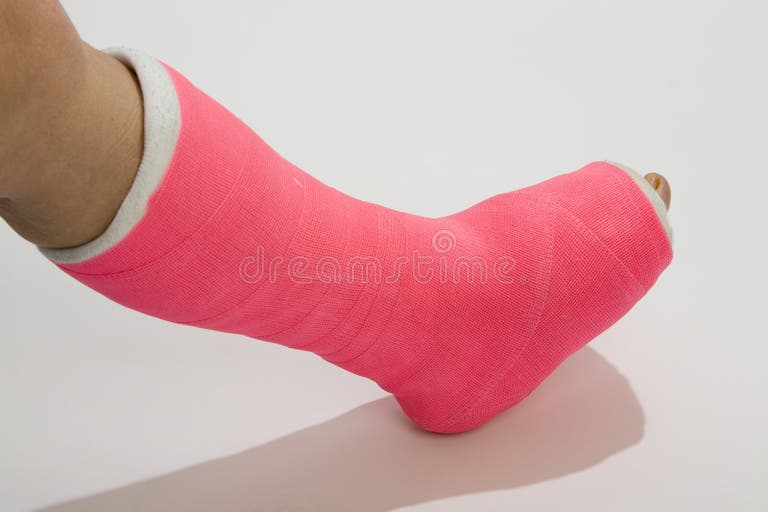 3,856 Pink Cast Stock Photos - Free & Royalty-Free Stock Photos from ...