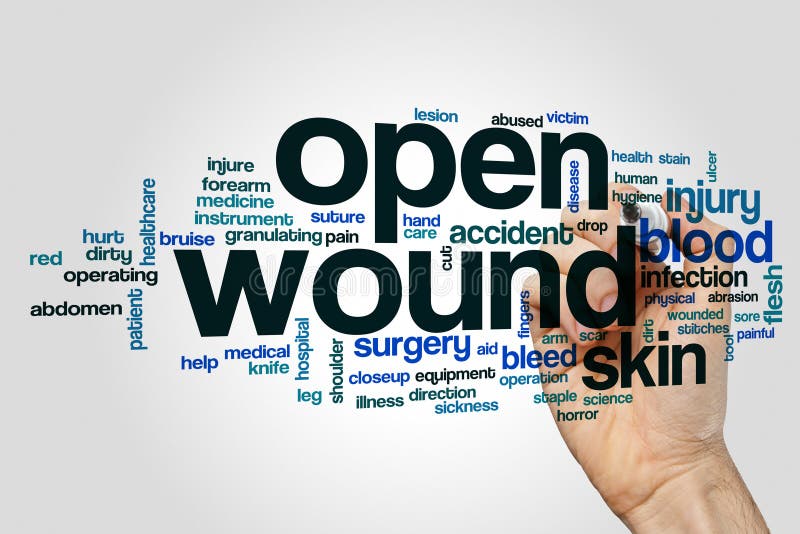 Open Wond Op Vrouwenschouder Stock Afbeelding - Image of geweld, wond ...