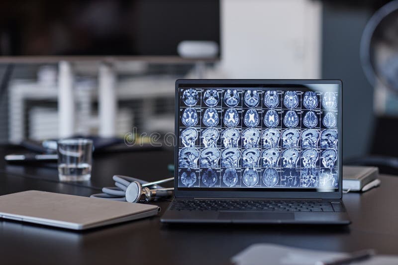 Image Open Mri Stock Photos - Free & Royalty-Free Stock Photos from ...