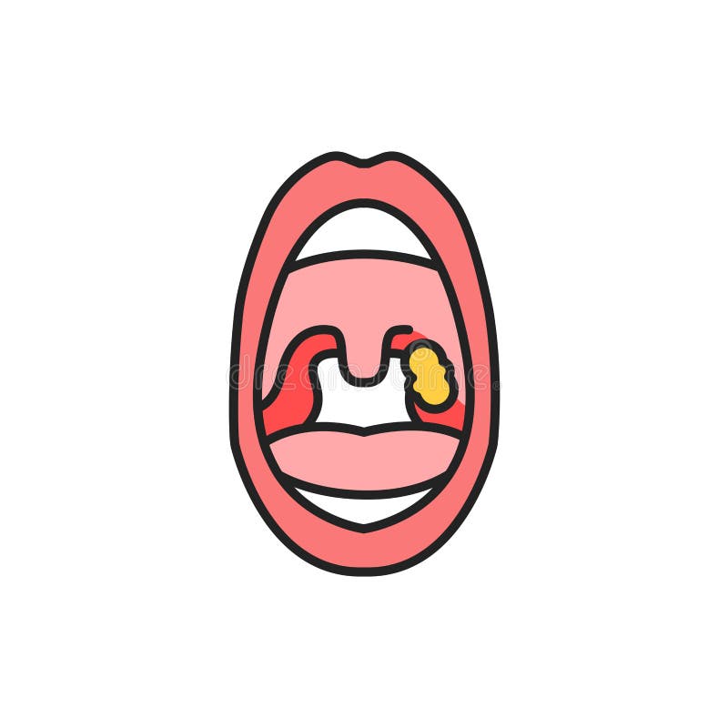 Open Mouth with Tonsillitis Line Color Icon. Sign for Web Page, Mobile ...