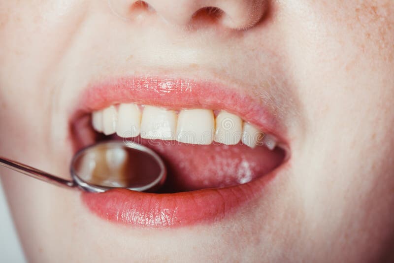 Check the teeth stock photo. Image of patient, dentist - 82548684