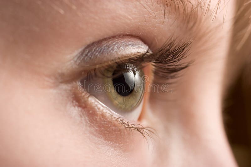 Sluit Een Ernstig Rood Oog Met Bloeduitstorting Virale Blefaritis ...