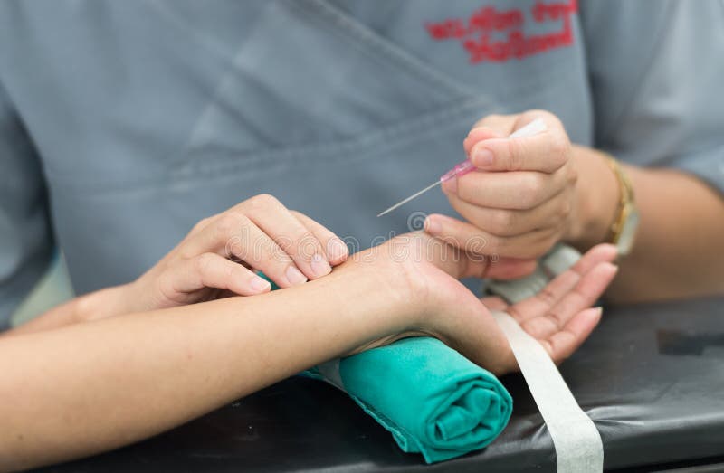 Open Radiale Slagader Voor Slagaderlijke Lijnmonitor Stock Foto - Image ...