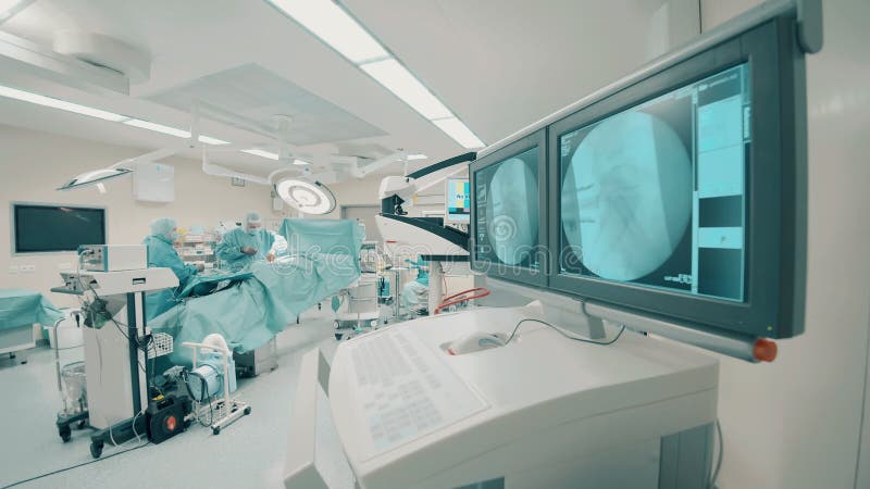 Operating Room with a Group of Surgeons and Scan Images Stock Footage ...
