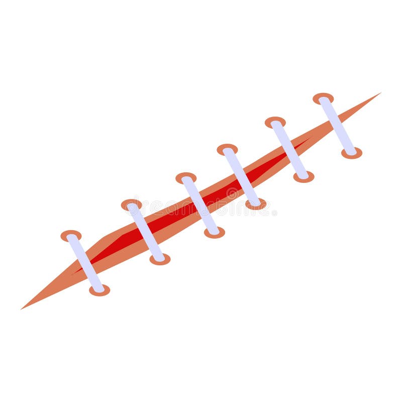 Operating Suture Icon, Isometric Style Stock Vector - Illustration of ...