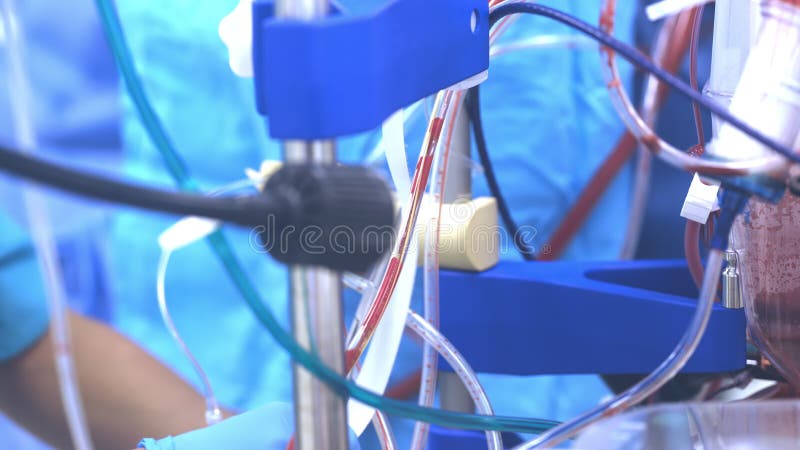 Operation of a Heart-lung Machine in the Operating Room during Heart ...