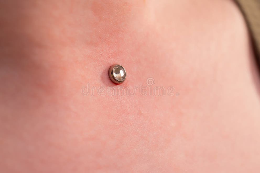Operation To Install Microdermal Piercing. Professional Placing Stock ...