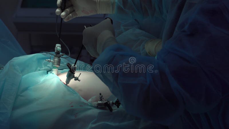 Operation Using Laparoscopic Equipment. Surgeons Team. Hospital. Stock ...