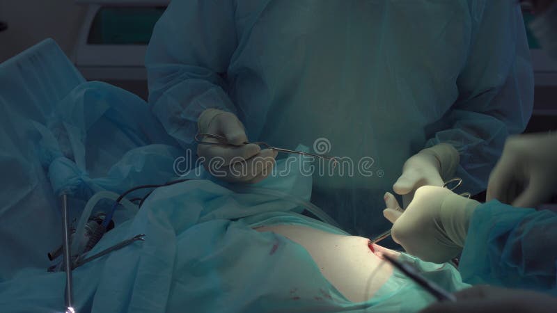 Operation Using Laparoscopic Equipment. Surgeons Team. Hospital. Stock ...