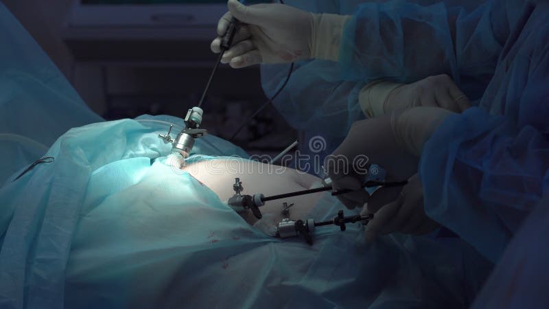 Operation Using Laparoscopic Equipment. Surgeons Team Working with of ...