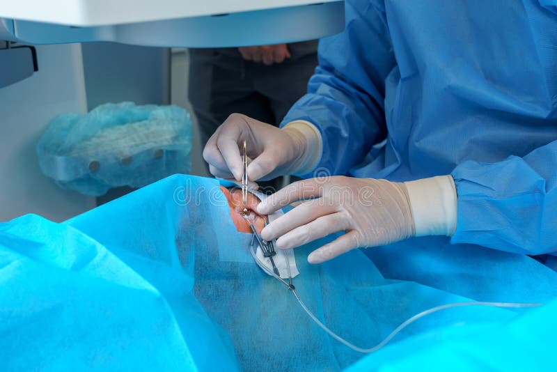 Ophthalmic Surgeon Performing Precise Eye Surgery Stock Image - Image ...
