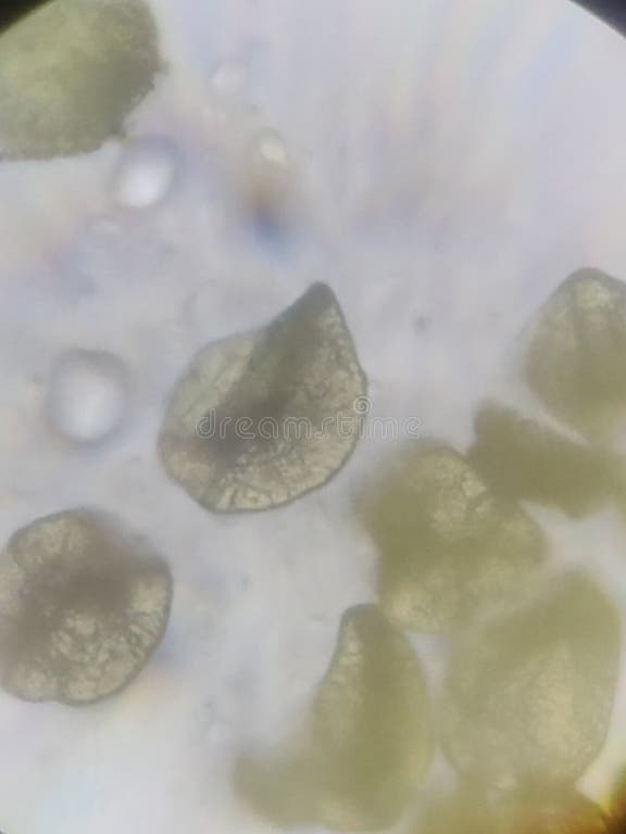 Pollen Under the Microscope Stock Photo - Image of science, microscope ...