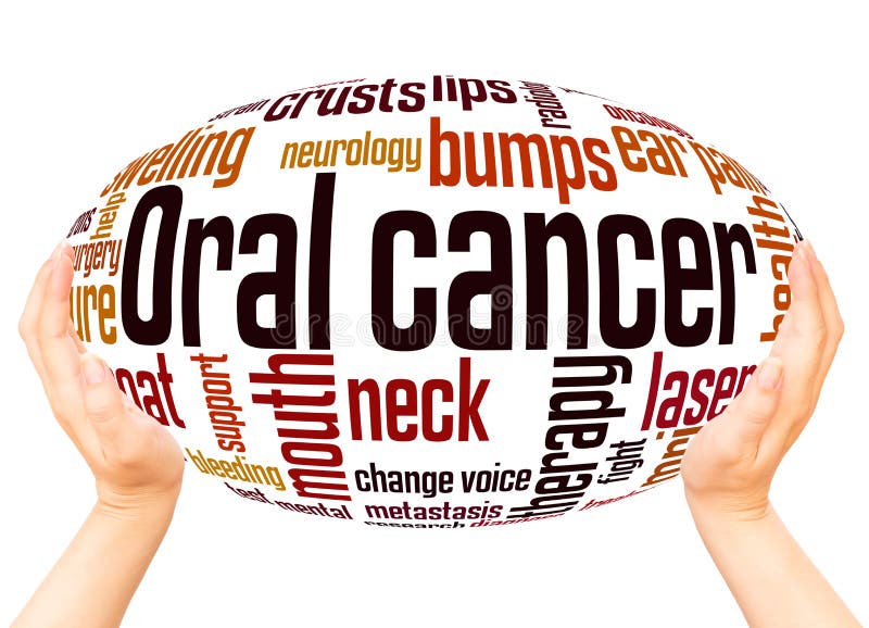 Oral Cancer Word Cloud and Hand with Marker Concept Stock Illustration ...
