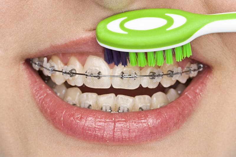 Oral hygiene stock image. Image of dentist, health, bacterial - 24427969
