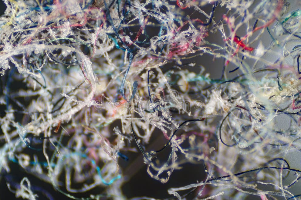 Ordinary House Dust Under the Microscope Stock Photo - Image of danger ...