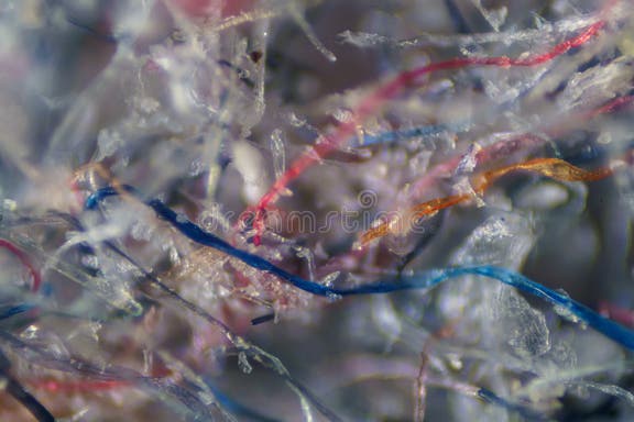 Ordinary House Dust Under the Microscope Stock Photo - Image of hygiene ...