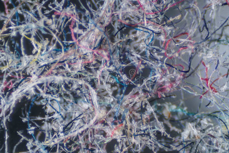 Ordinary House Dust Under the Microscope Stock Photo - Image of ...