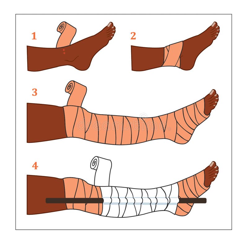 Common First Aid Situation - Snake Bite Stock Illustration ...