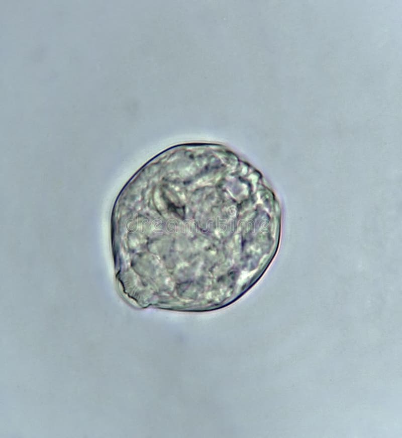 Organisme unicellulaire photo stock. Image du surface - 11469800