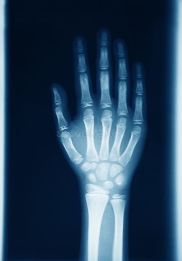 Radiography of hand stock image. Image of hand, halloween - 45719005