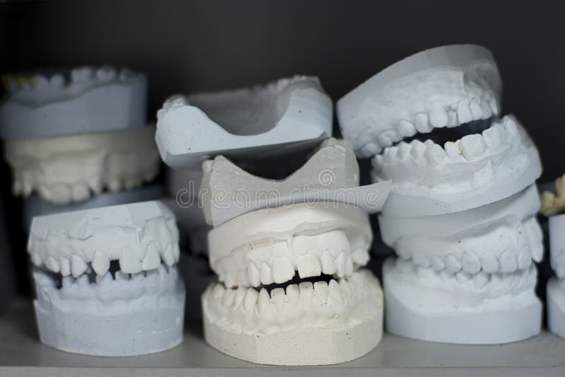 Ortho Casts Plaster Models Close-up Stock Image - Image of mould ...