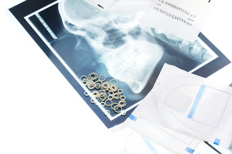 Tooth Xray Clip Stock Photos - Free & Royalty-Free Stock Photos from ...