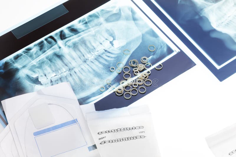 Tooth Xray Clip Stock Photos - Free & Royalty-Free Stock Photos from ...