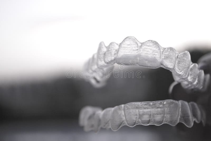 Orthodontics To Correct Alignment of Teeth Stock Photo - Image of align ...
