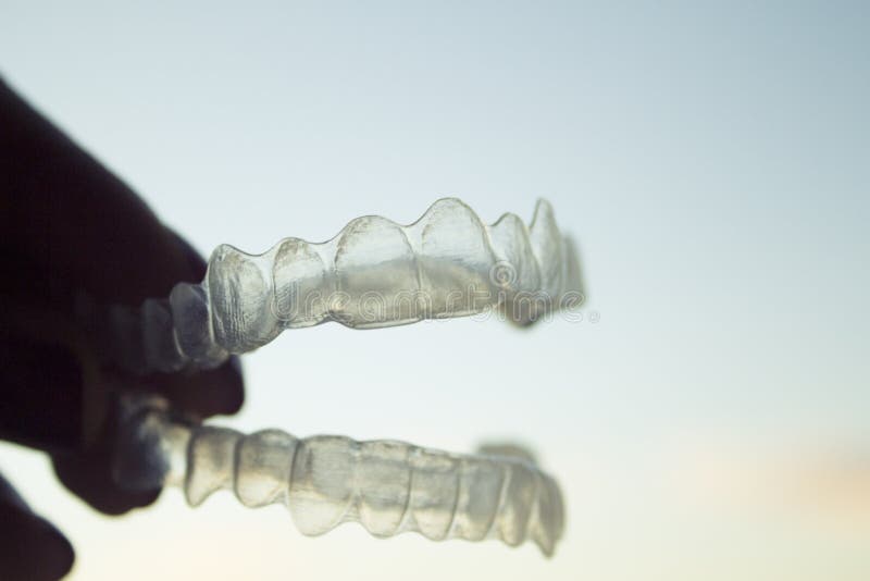 Orthodontics To Correct Alignment of Teeth Stock Photo - Image of ...