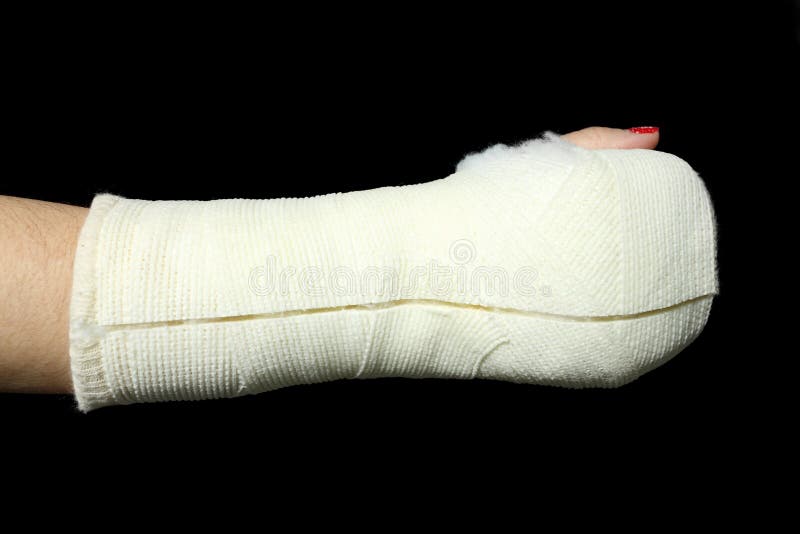 Orthopedic cast stock photo. Image of surgical, medical - 49499532