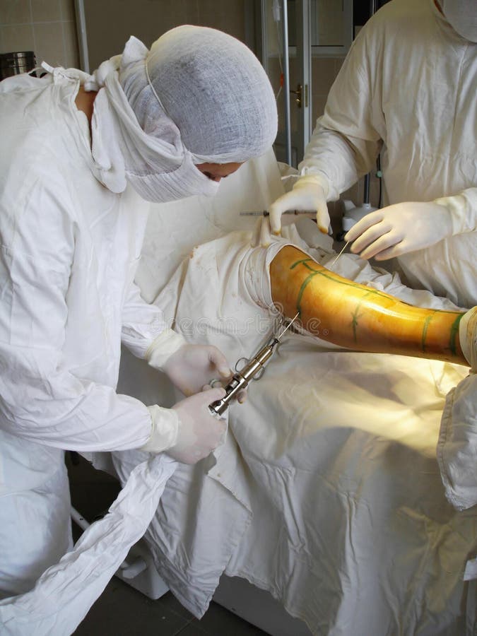 Orthopedic operation stock image. Image of instruments - 898875