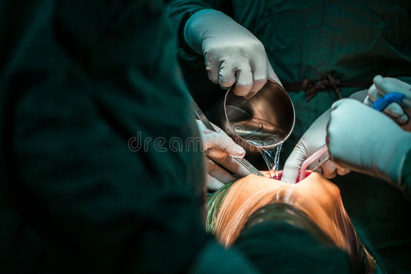 Orthopedic Surgeons in Teamwork in the Operating Room with Modern ...