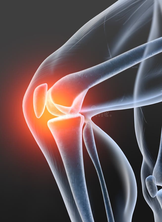 Osteoarthritis, Painful Knee Joint, 3D Illustration 2 Stock Photo ...