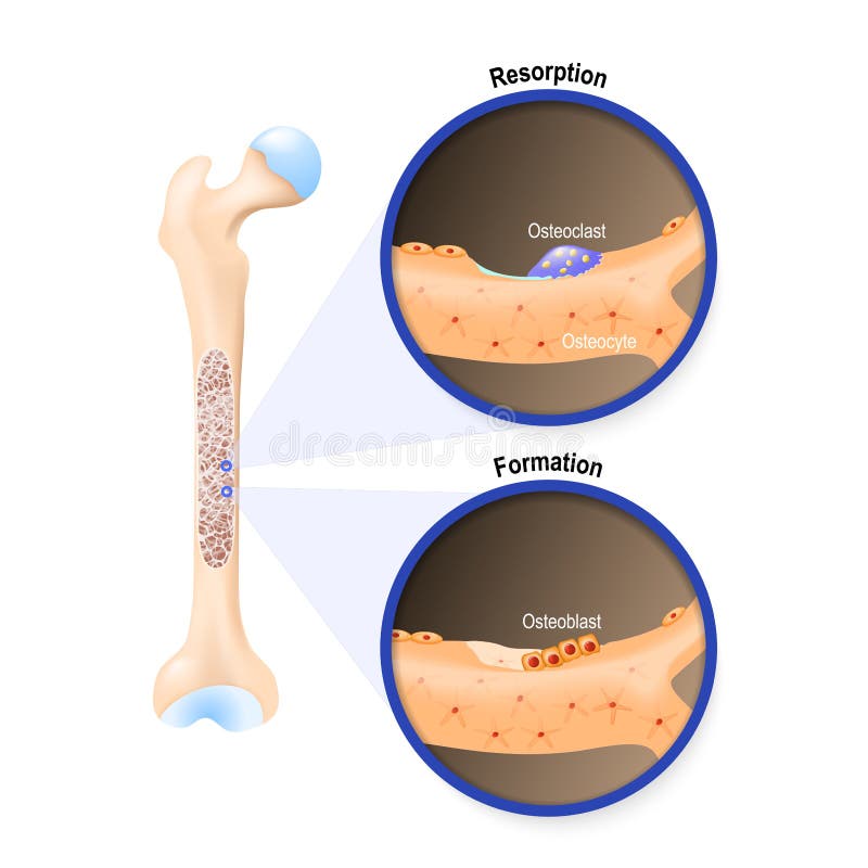 Processo Di Rimodellamento Osseo Osteoblast, Osteoclast E Osteocita ...