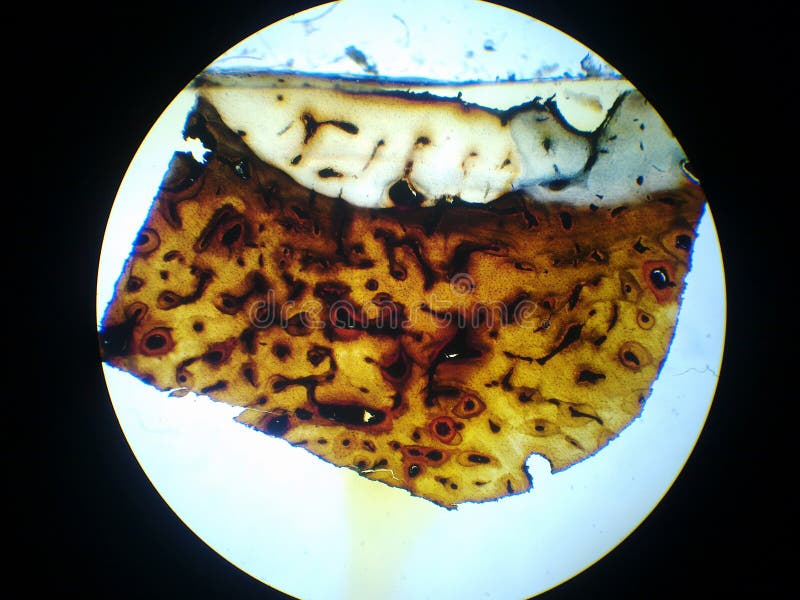 Osteocyte; Osteocytes; Pilha De Osso Foto de Stock - Imagem de nave ...