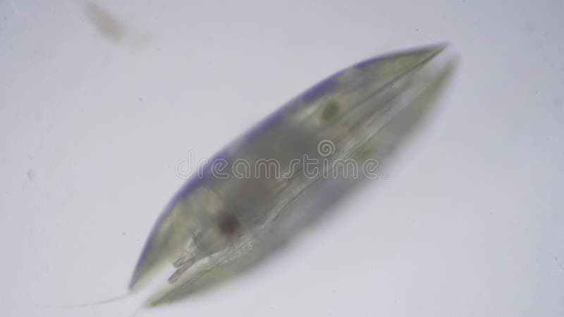 Ostracods of Class of the Crustacea Stock Video - Video of biologist ...