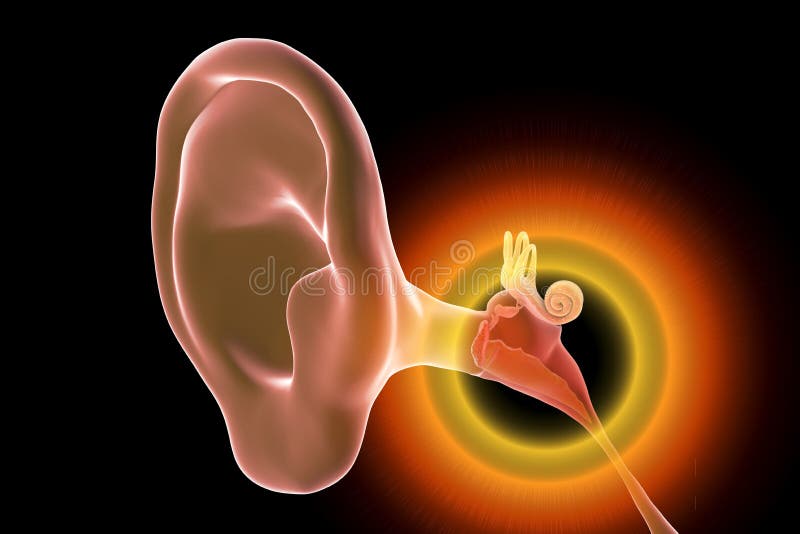 Otitis media, illustration stock illustration. Illustration of ...