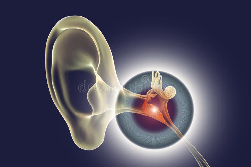 Otitis media, illustration stock illustration. Illustration of canal ...