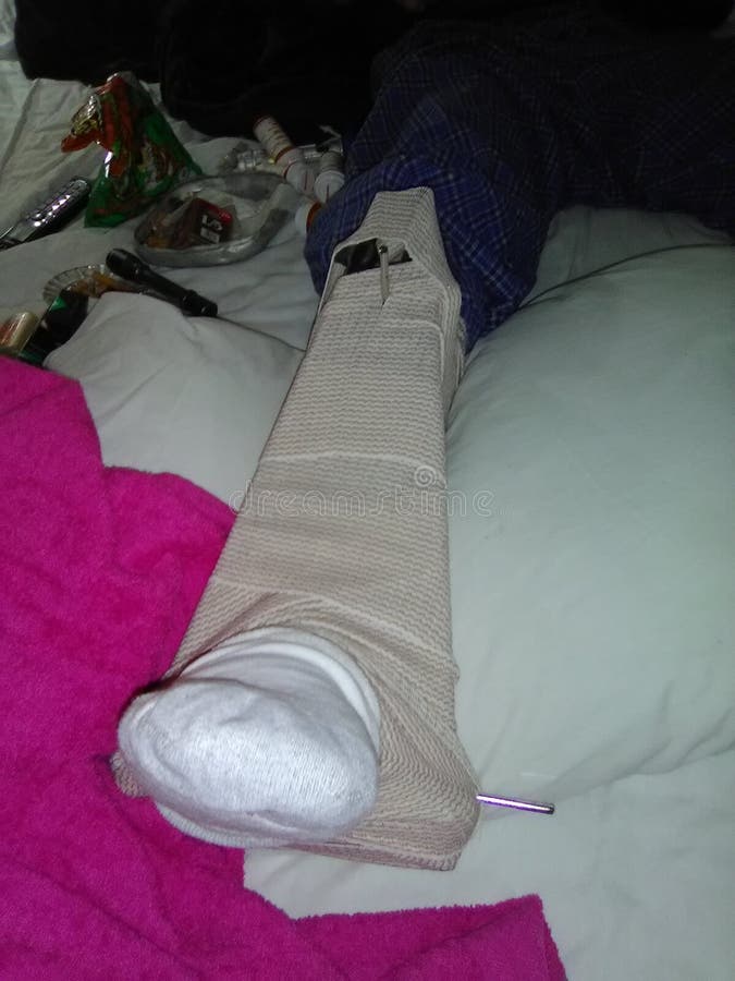 Ouch stock image. Image of conceptual, ouch, firstaid - 22055517