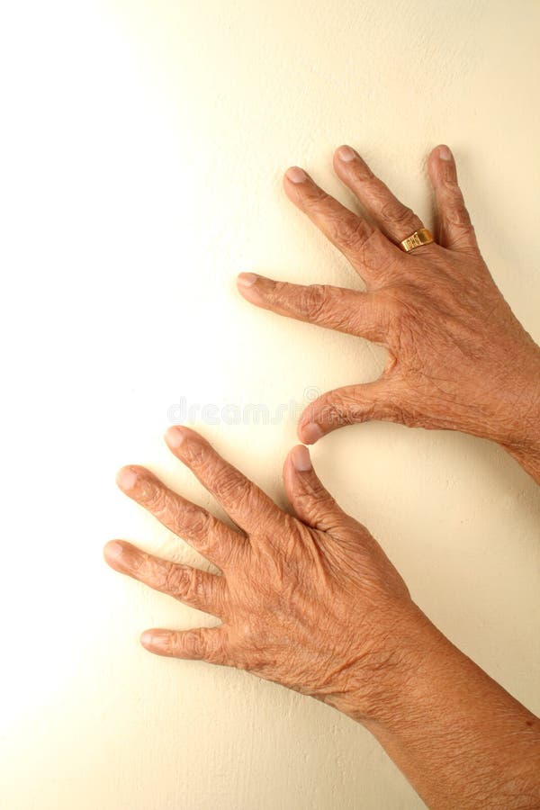 Hoog Gezichtsveld Van De Handen Die Droog Zijn Op De Huid En Diepe ...