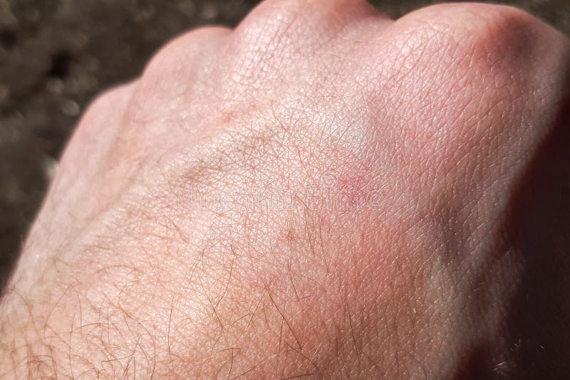 Outer Part of the Human Hand. Close-up Human Skin on the Palm Stock ...