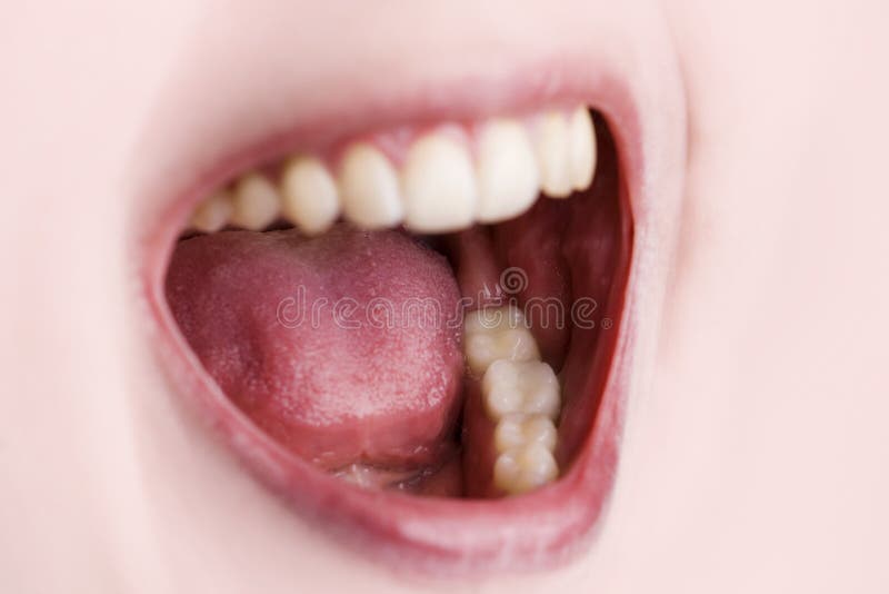 Ouvrez La Bouche Et Les Dents Photo stock - Image of fille, heureux ...