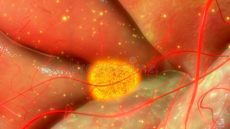 Ovariale follikels stock illustratie. Illustration of ovarium - 73450767