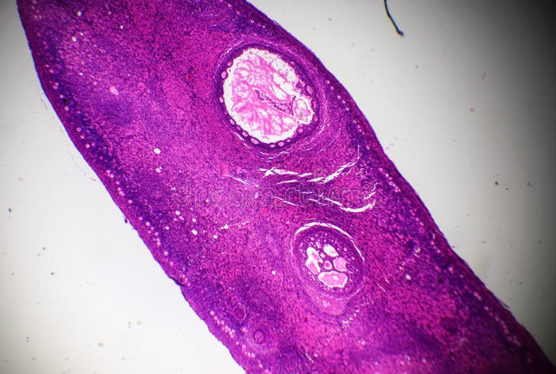 Ovary Section Under the Microscope Stock Photo - Image of human, pelvic ...
