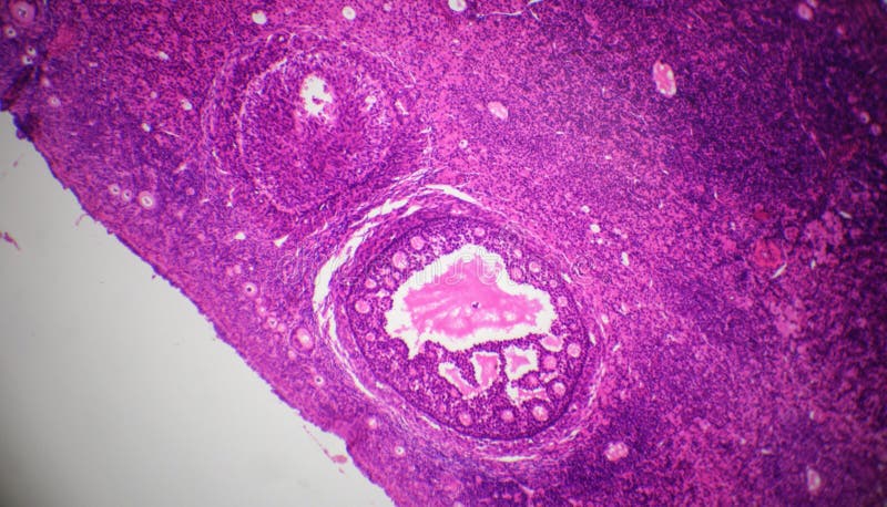Ovary Section Under the Microscope Stock Image - Image of biology ...