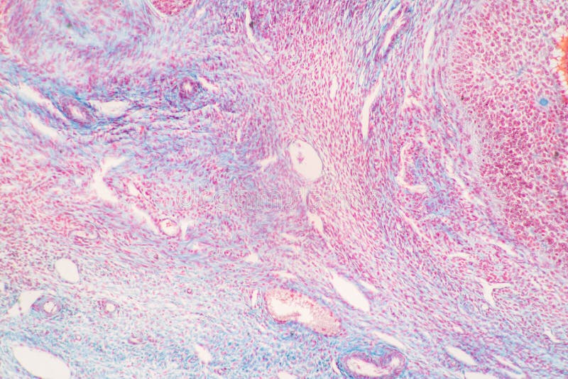 Ovary and Testis Human Cells Under Microscope. Stock Photo - Image of ...