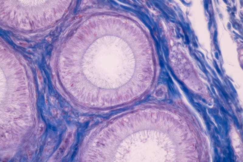 Ovary and Testis Human Cells Under Microscope. Stock Photo - Image of ...