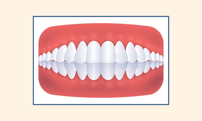 Overbite Human Teeth Icon on Yellow Stock Illustration - Illustration ...