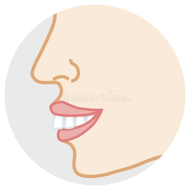 Overbite Teeth -Face Close-up, Side View Stock Vector - Illustration of ...